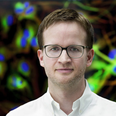 Prof. Dr. Martin Glas - Translationale Neuroonkologie Essen